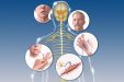 Tratamentos para Esclerose Lateral Amiotrófica: cuidados para doença ELA
